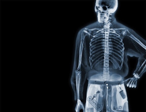 Stunning X-ray photos of human body - Global Times