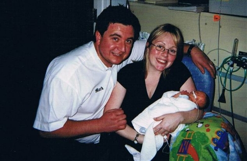 British boy born with half face - Global Times