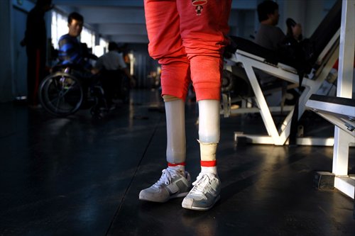 The unsung champions - Global Times