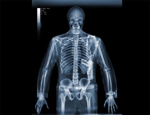 Stunning X-ray photos of human body - Global Times