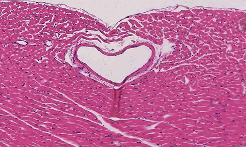 Heart Microscope Slide