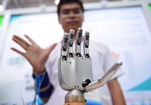 Prosthetic innovation: ‘It’s like you have a hand again,’ says study ...