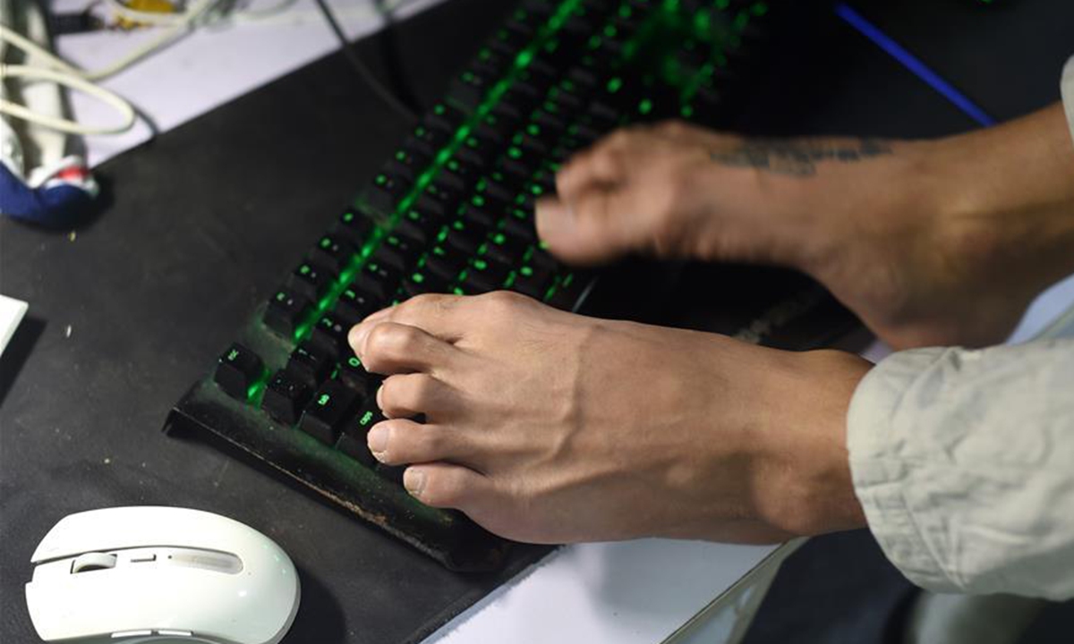 Pic story: armless man and his online store - Global Times