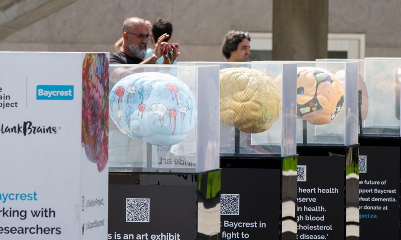 Brain Project art exhibition held in Toronto, Canada - Global Times