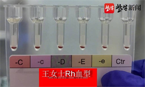 Two persons with rarest ‘Golden Blood’ found in East China, raising ...